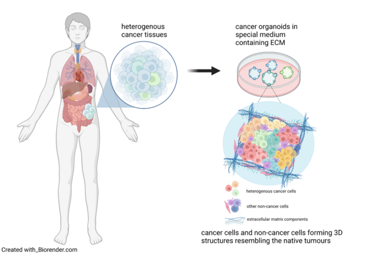 Miniaturised Replicas of Tumours are Changing How we Look at Cancer ...